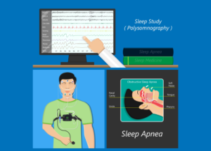 Understanding Sleep Test Results - Millennium Sleep Lab